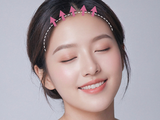 Forehead & Eyebrow Thread Lift in Korea - PangPang Clinic in Gangnam